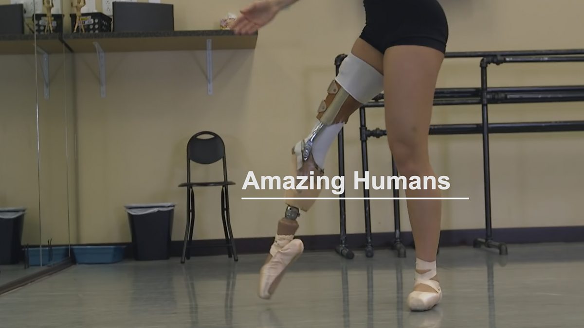 BBC Three - Amazing Humans, The disabled dancer who went viral