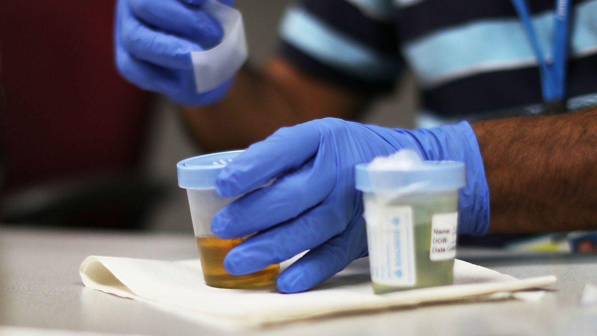 BBC World Service - Newsday, The urine test that can determine your health