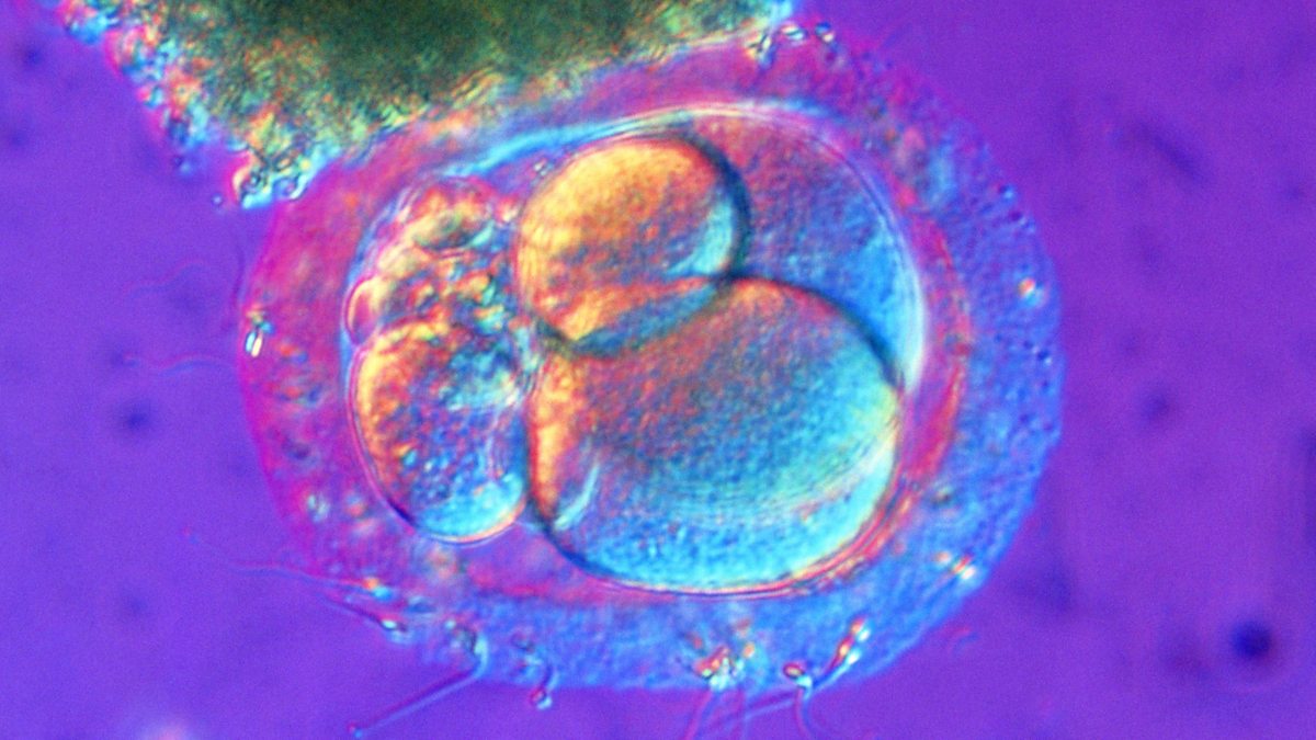 BBC World Service - Discovery, Extending Embryo Research