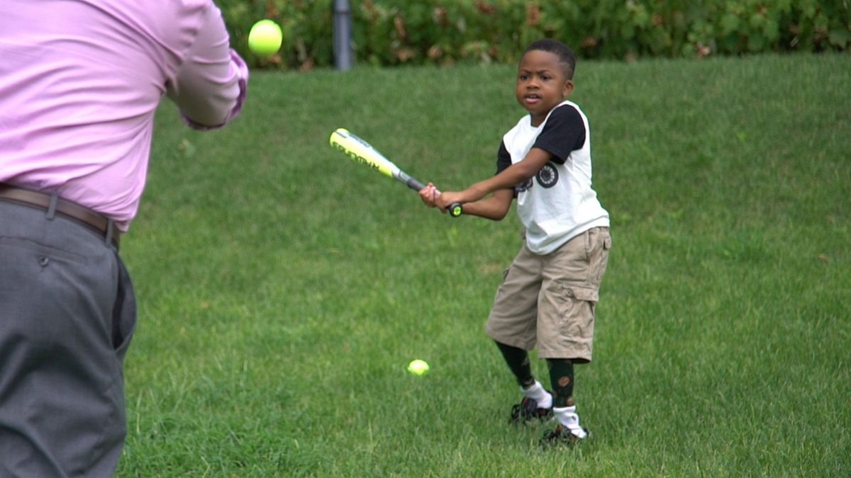 BBC World Service - Newsday, Double hand transplant boy takes up baseball