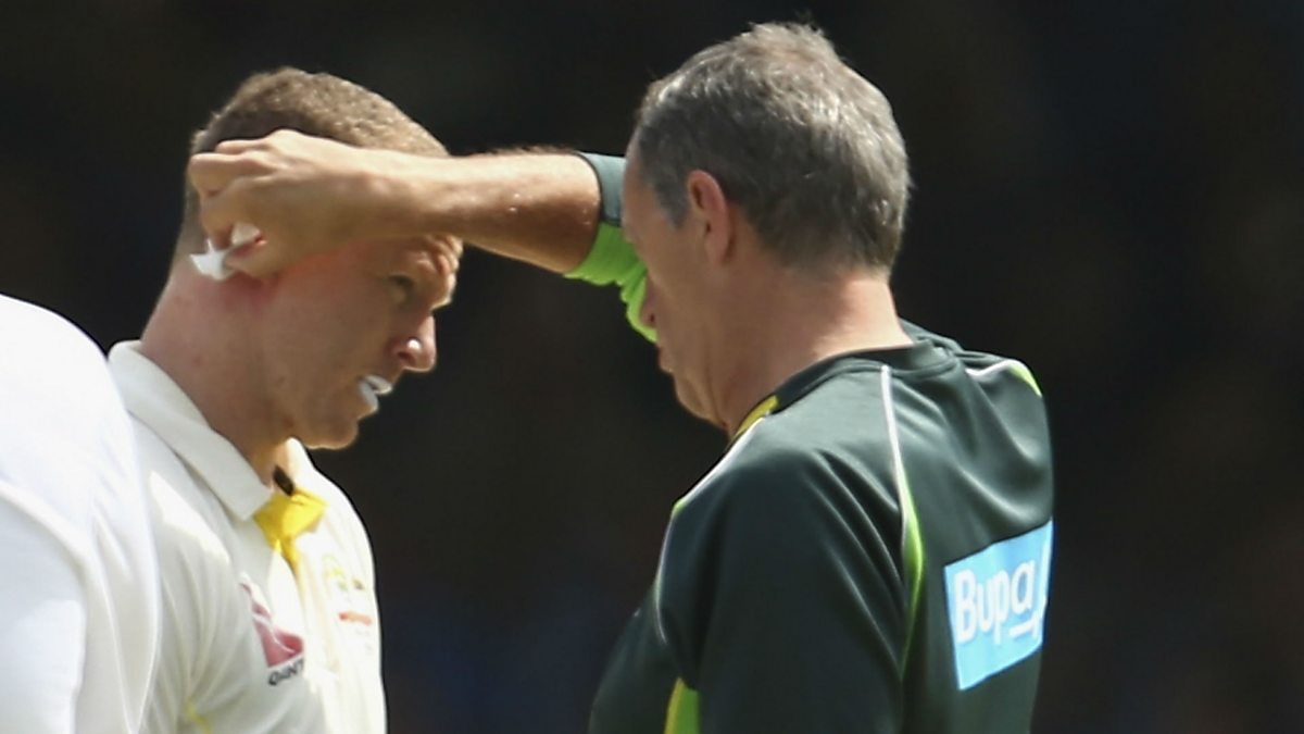 BBC World Service - Stumped, 'Cricket needs to take concussion seriously'