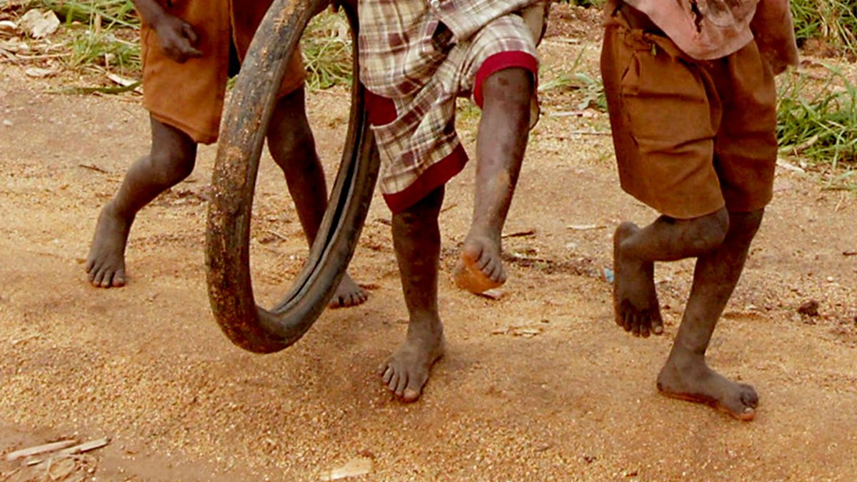 BBC World Service - Health Check, Podoconiosis: The little known ...