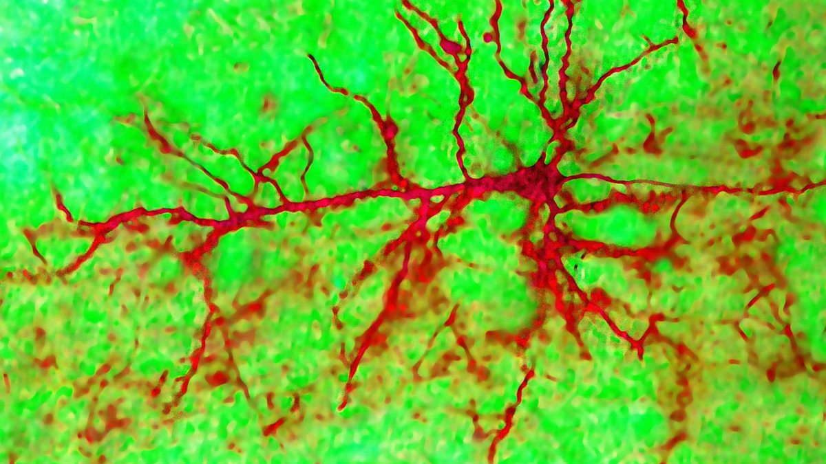 BBC World Service - Science In Action, How a soft brain probe could ...