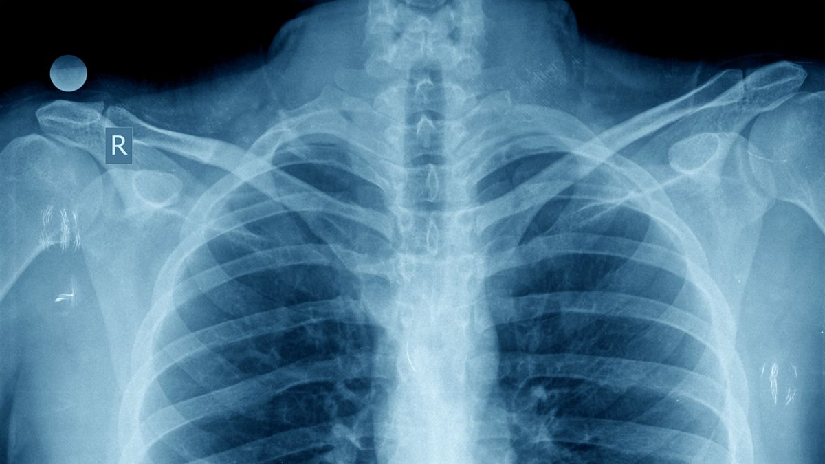 BBC World Service - Newsday, How AI could speed X-ray processing