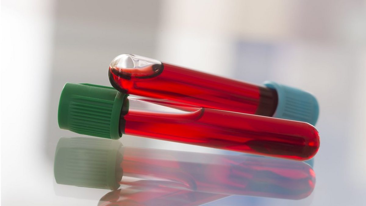 BBC World Service - Business Daily, Bad blood in Silicon Valley