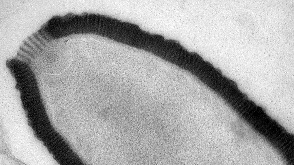 BBC World Service CrowdScience Could A zombie Virus Kill Us All BBC World Service CrowdScience Could A zombie Virus Kill Us All