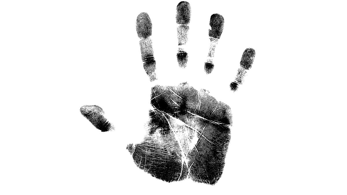 BBC Radio 4 - The Remarkable Life of the Skin