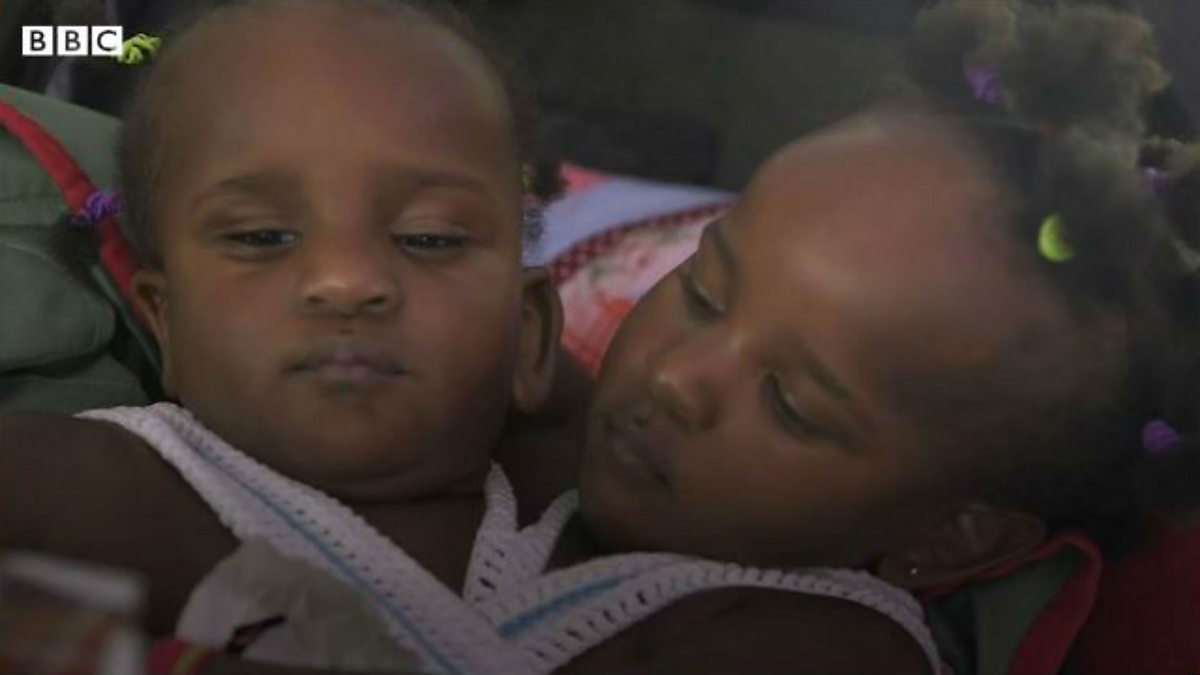 BBC World Service - Newsday, ‘Why I didn’t separate my conjoined twins’