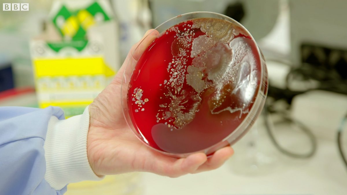 BBC Four - Secrets of Skin, Series 1, Protection, Diverse bacteria ...