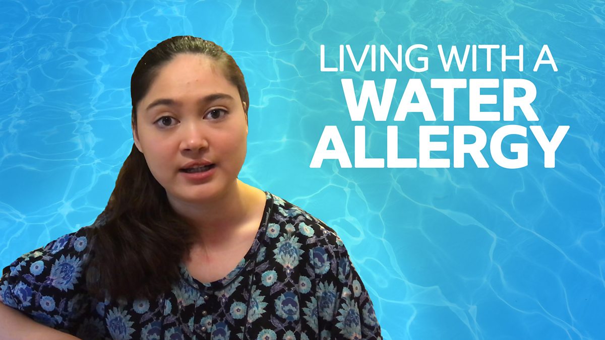 BBC - The Social, My Bizarre Allergy!