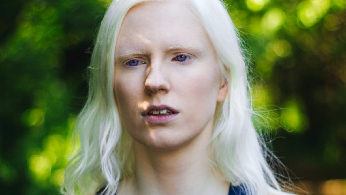 BBC - The Social - Spoken word helps me express my experience of albinism