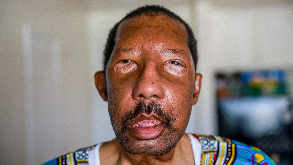 BBC News - I Am Robert