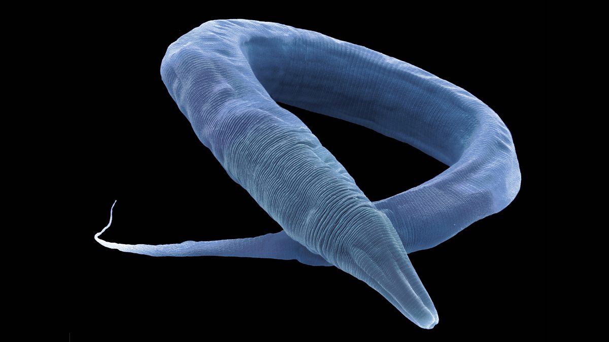 BBC World Service - Witness History, How a worm helped explain human ...