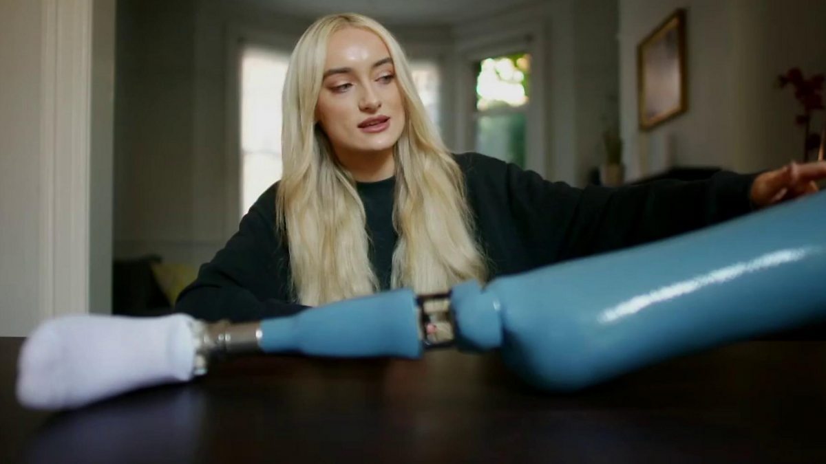 BBC One - Our Lives, Series 5, The Girl with the Colourful Leg ...