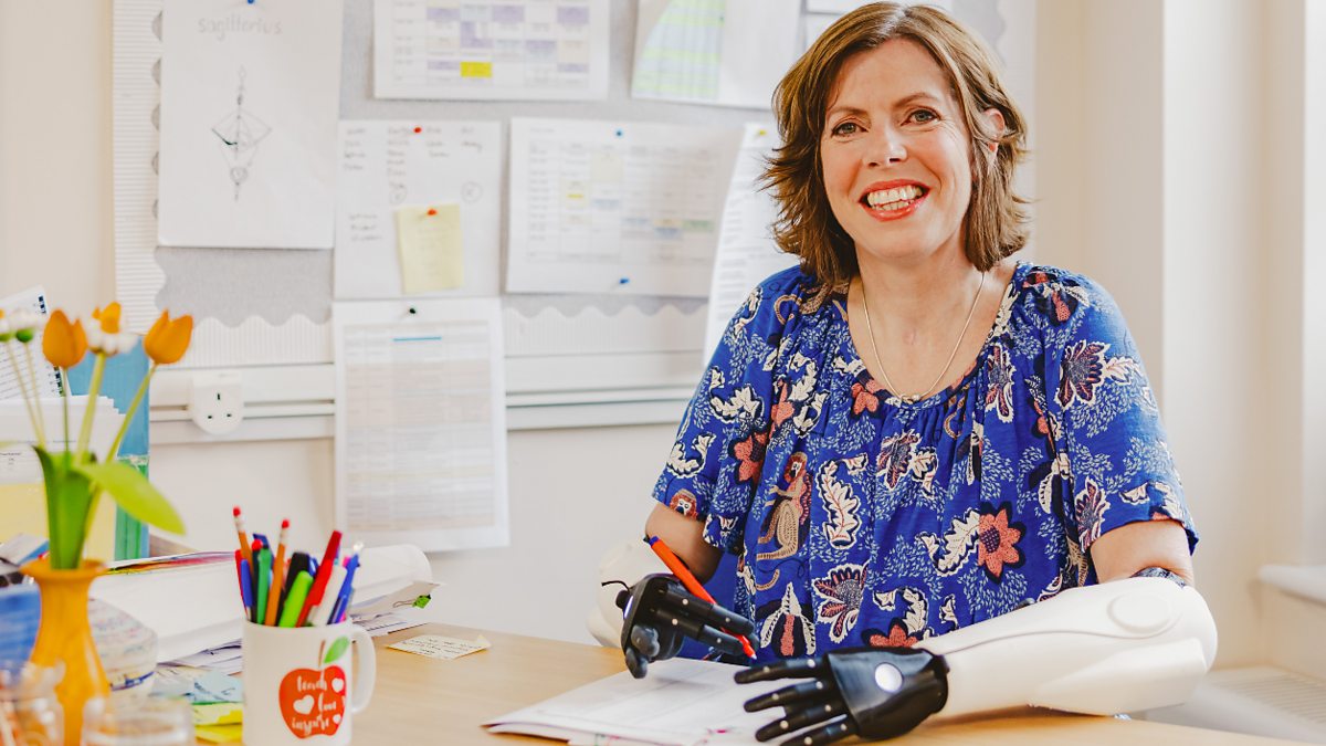 BBC World Service - Newsday, 'Bionic' teacher back in class thanks to ...
