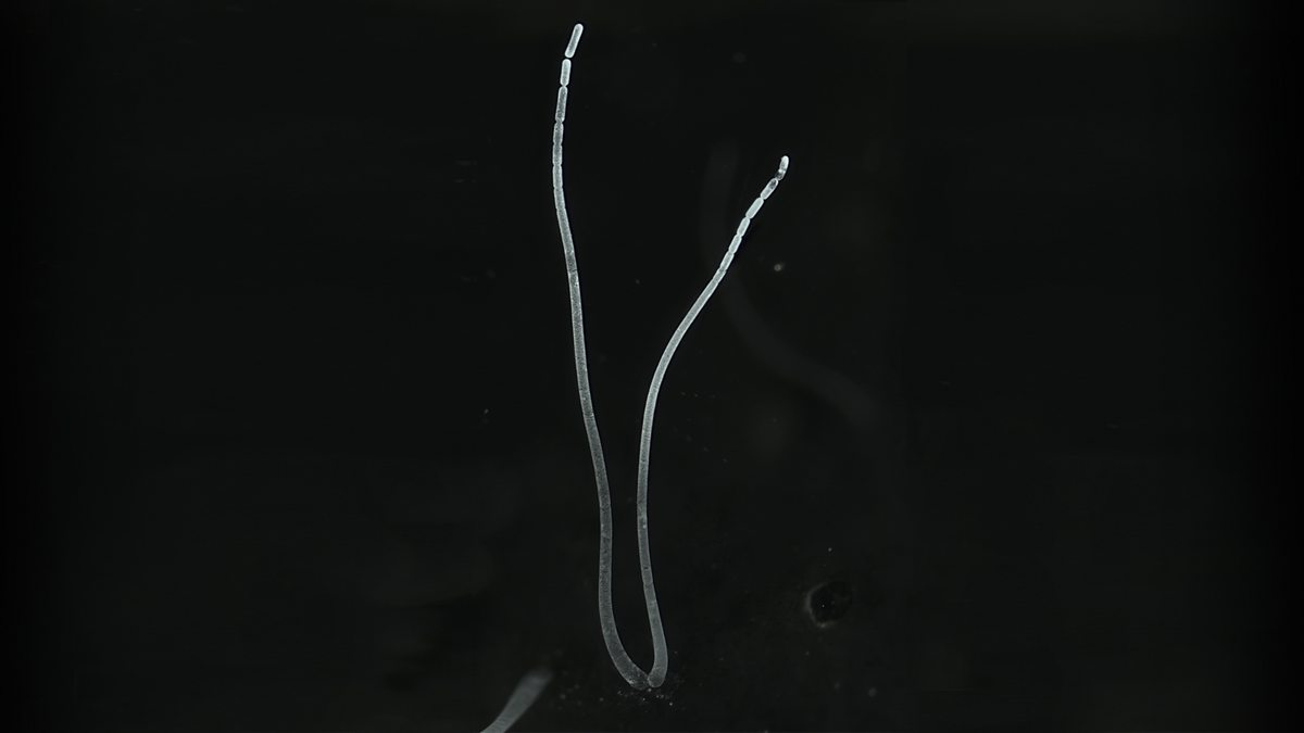 BBC World Service - Science In Action, Monster microbe