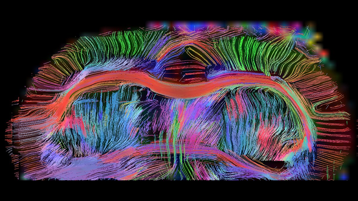 BBC World Service - Science In Action, Inserting human neurons into the ...