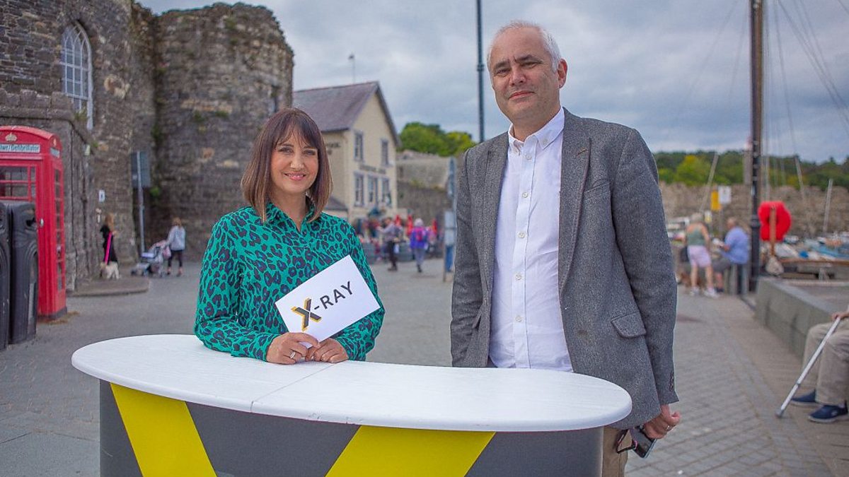 BBC One - X-Ray, Ask The Expert: Prof Richard Fitton