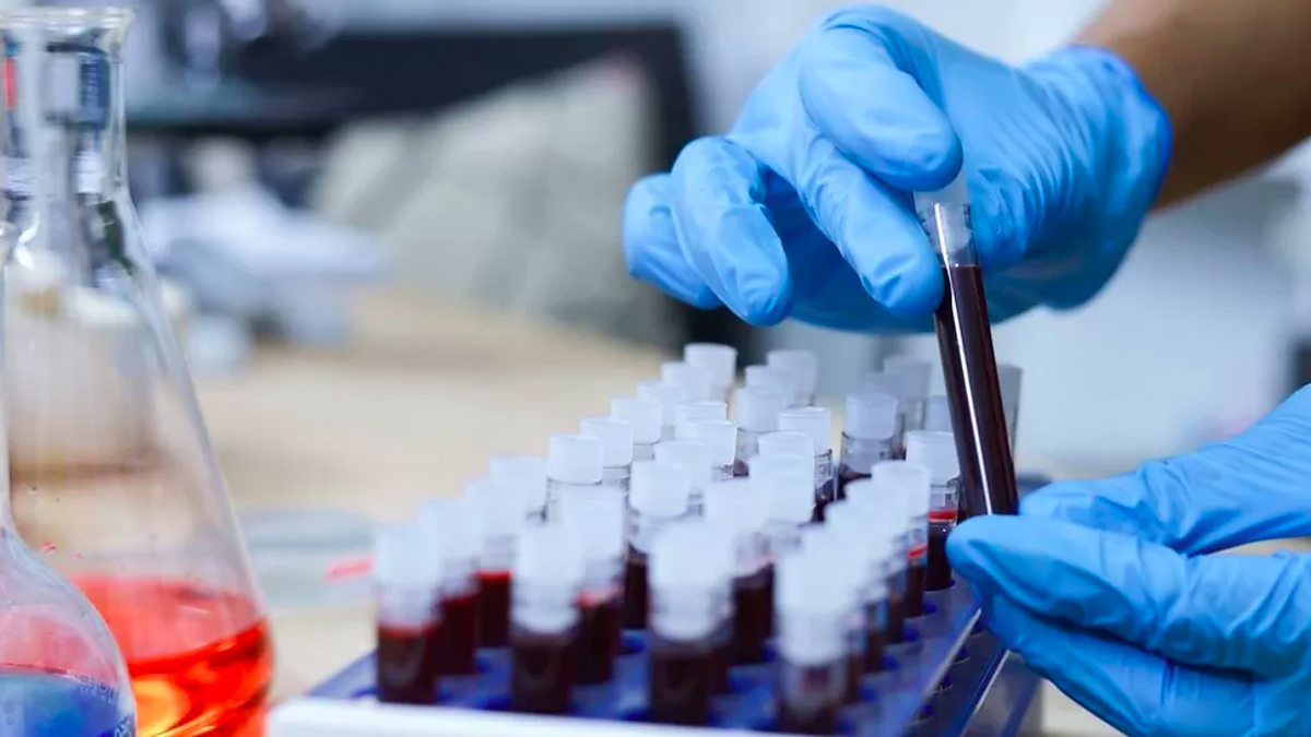 BBC World Service - Newsday, Can gene editing be the cure for cancer?