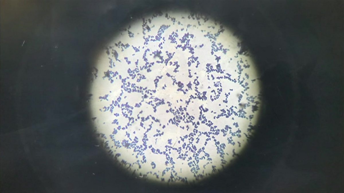 BBC Radio Newcastle - Matt Bailey, A1 dualling in Northumberland ...