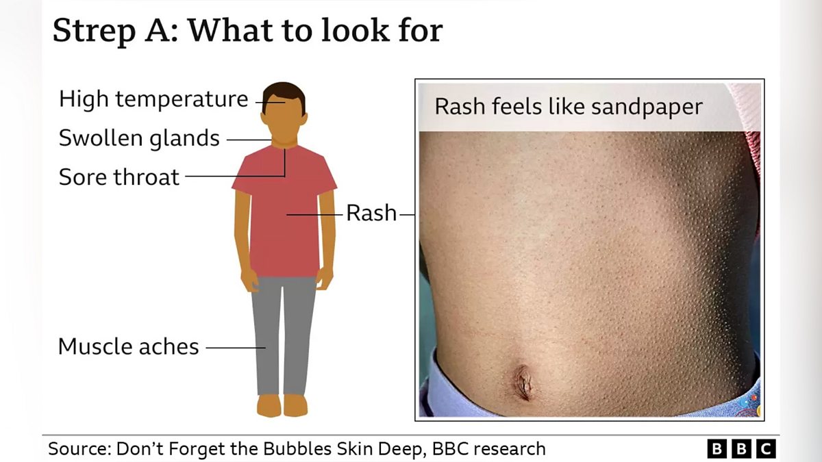 BBC Radio Nottingham - Verity Cowley, What is Strep A and what are the ...