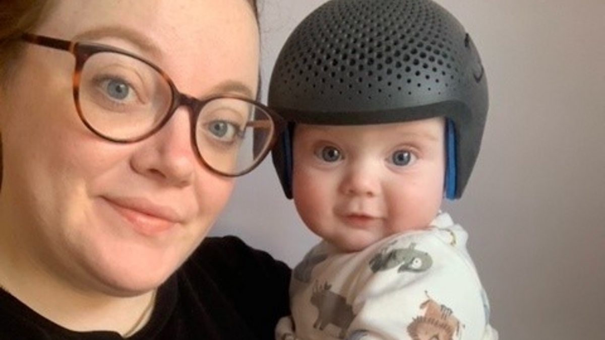 BBC Radio Tees - Neil Green, Living with Craniosynostosis