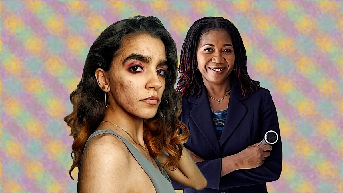 BBC World Service - The Conversation, Me and my acne