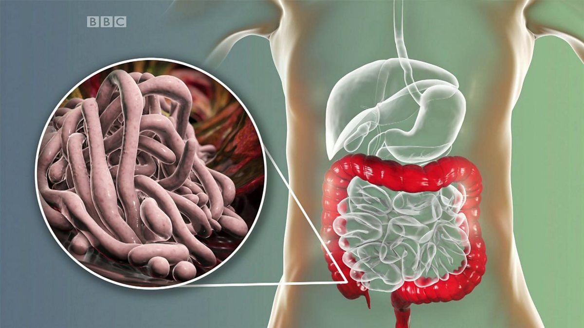 BBC World Service TV - Life Clinic, When was the last time you dewormed?