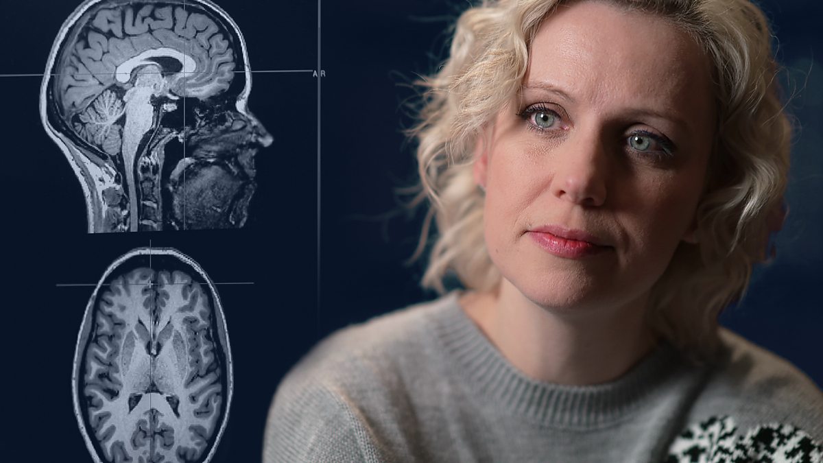 S4C - Alex Humphreys: Epilepsi a Fi