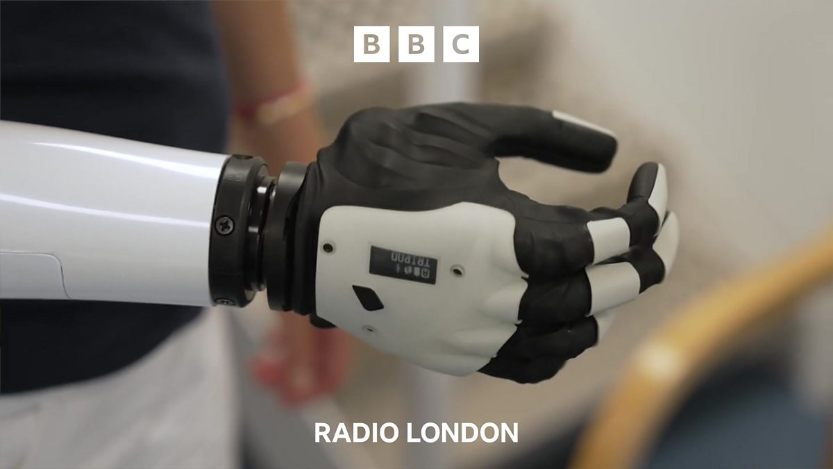 BBC Radio London - BBC Radio London, Tube accident survivor gets new ...