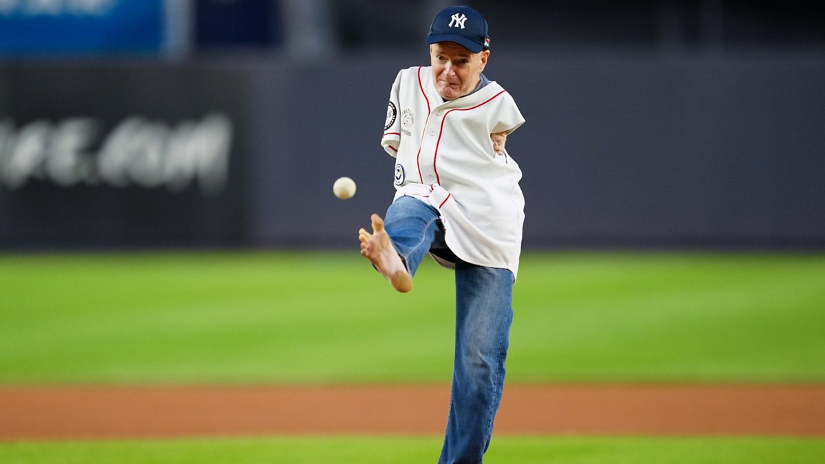 BBC World Service - Not by the Playbook, Baseball fan born without arms ...