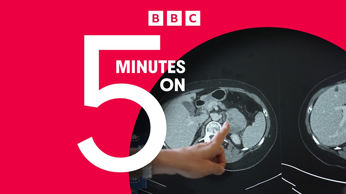 BBC News - Latest News Picks, AI and Cancer Diagnosis - "An absolute ...