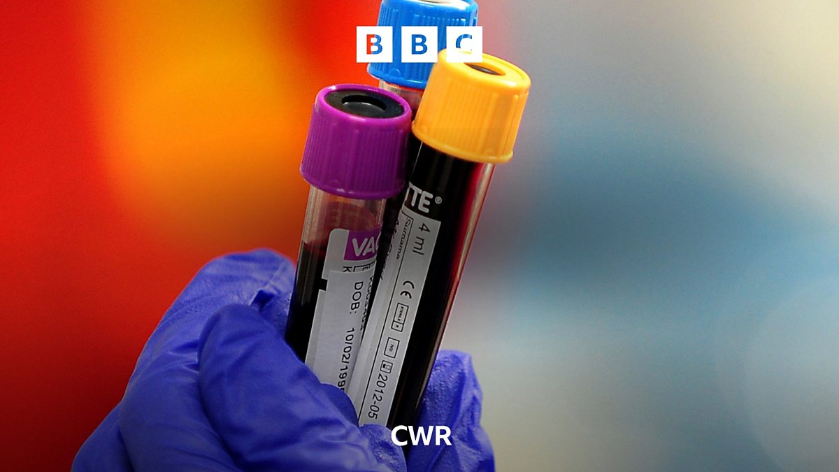 Blood Tests Coventry University Hospital at Mary Lockridge blog
