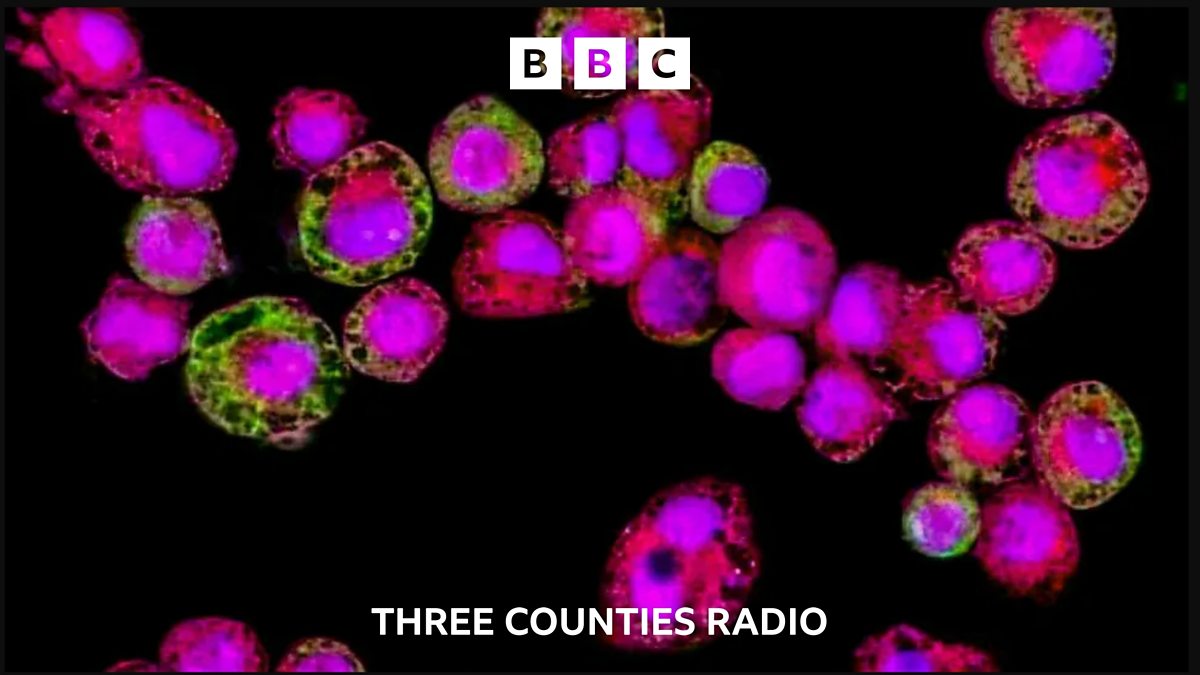 BBC Three Counties Radio - BBC Three Counties Radio, '3D lung': a step ...