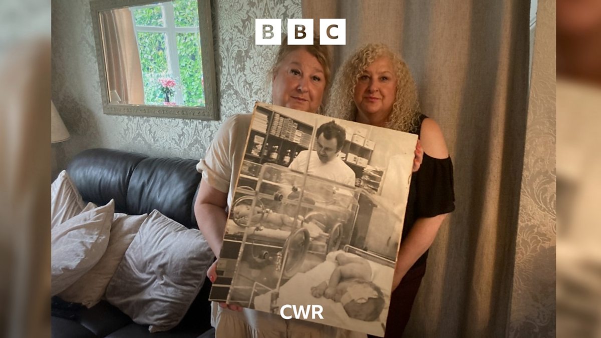 BBC CWR - Secret Coventry, Coventry's conjoined twins