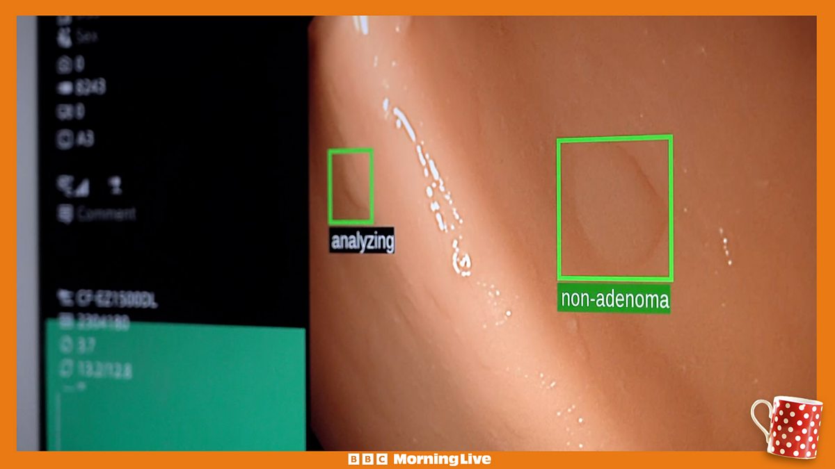 BBC One - Morning Live, How can AI help save lives?