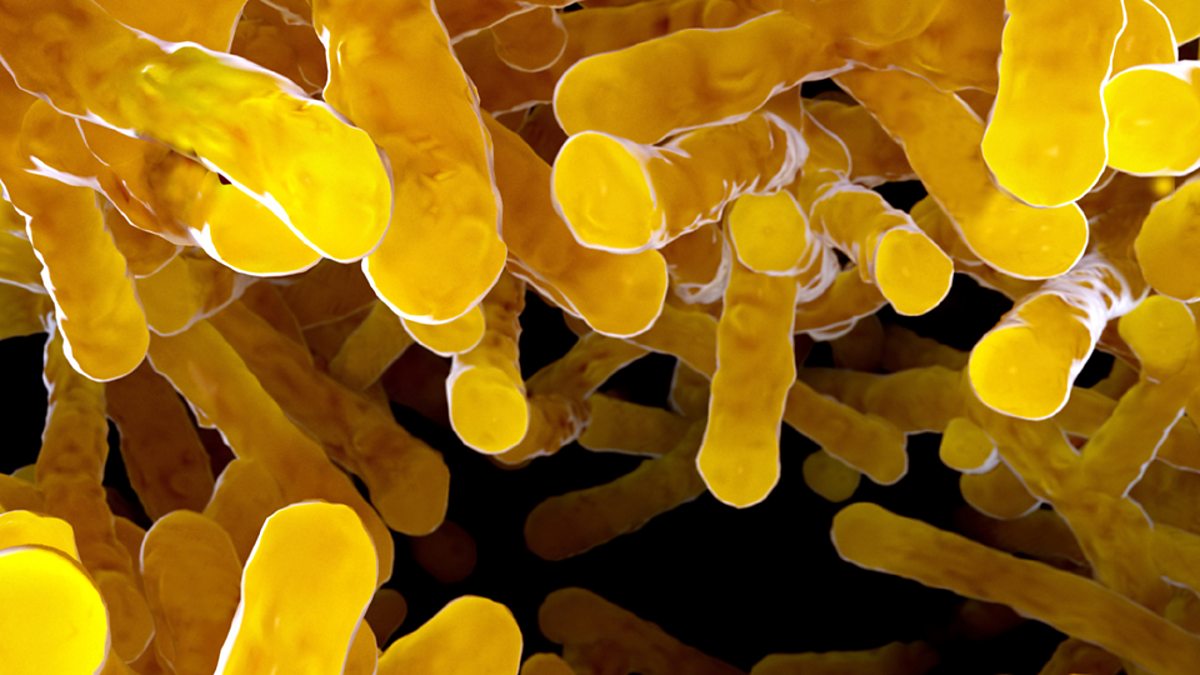 BBC Learning English - 媒体英语 / Superbugs warning 警告：对抗“超级细菌”刻不容缓