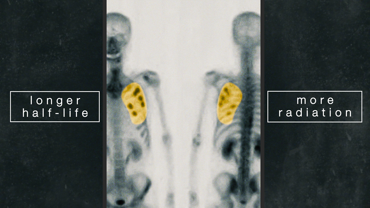 Video: Use of radioisotopes - Revision guides: Chemistry in society ...