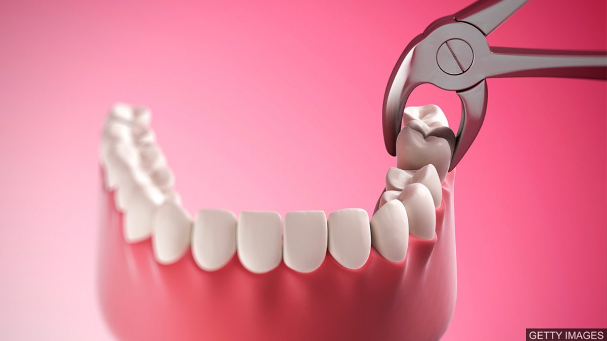 BBC Learning English - 今日短语 / Like pulling teeth 非常困难