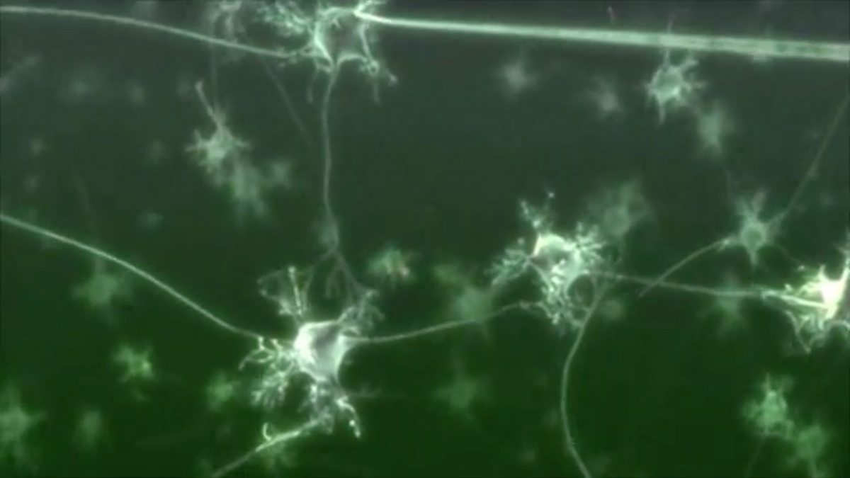 Reflex actions - The nervous system – WJEC - GCSE Biology (Single ...