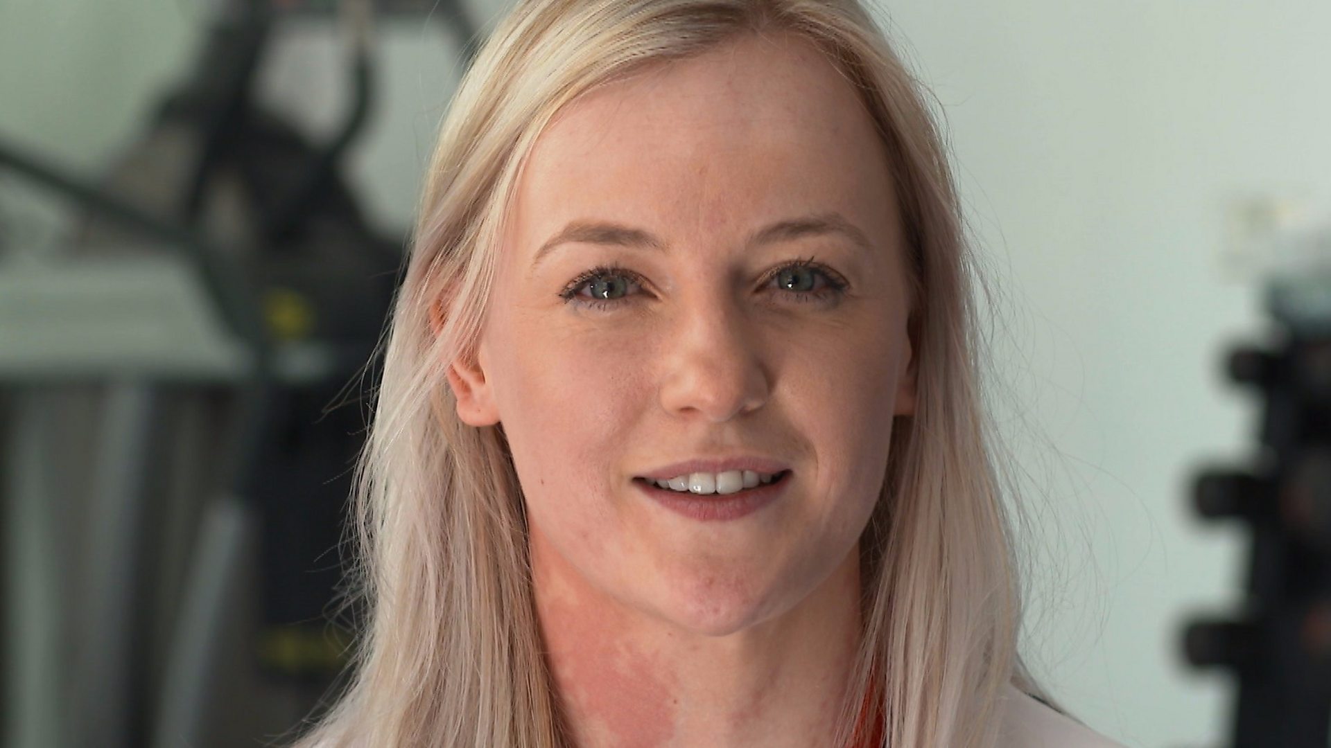 Penny Coomes The Gb Skater Who 39smashed Her Knee Into