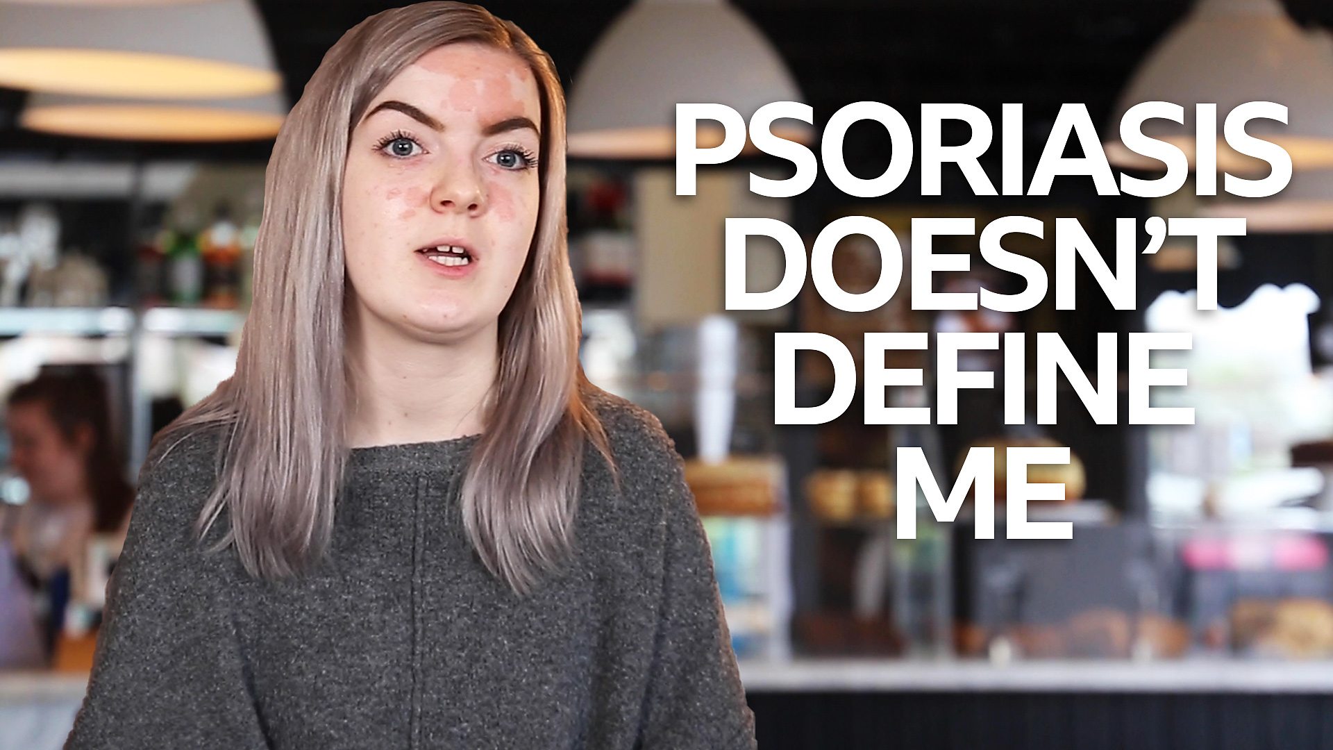 BBC Scotland - The Social, Psoriasis Doesn't Define Me