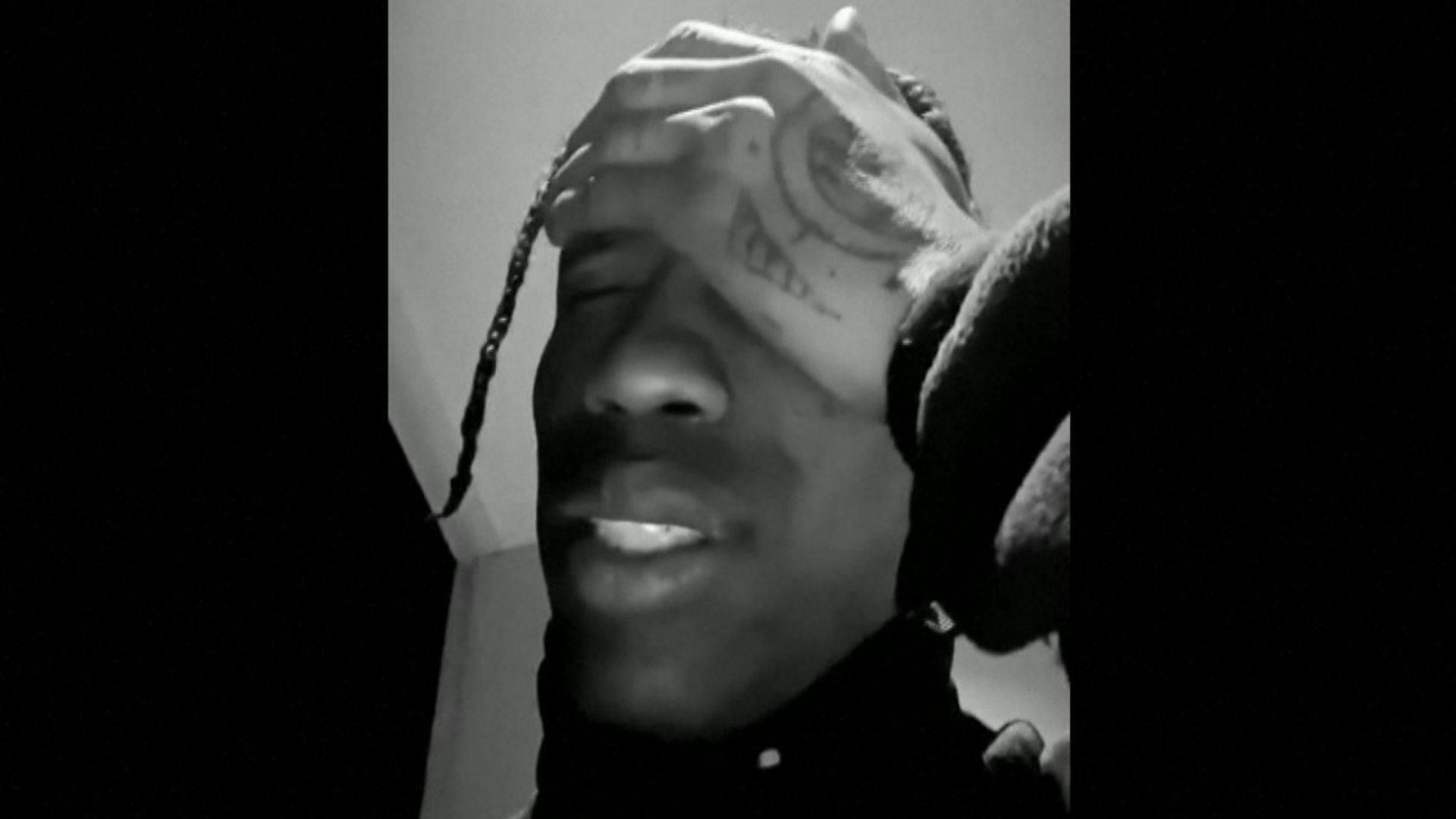 Travis Scott Teeth White One Hour Is All It Takes To Transform