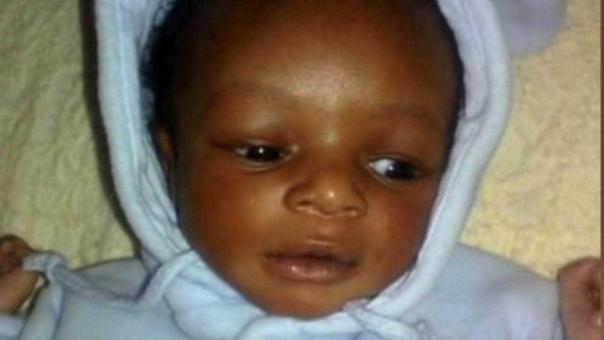 BBC World Service TV - Life Clinic, Hydrocephalus
