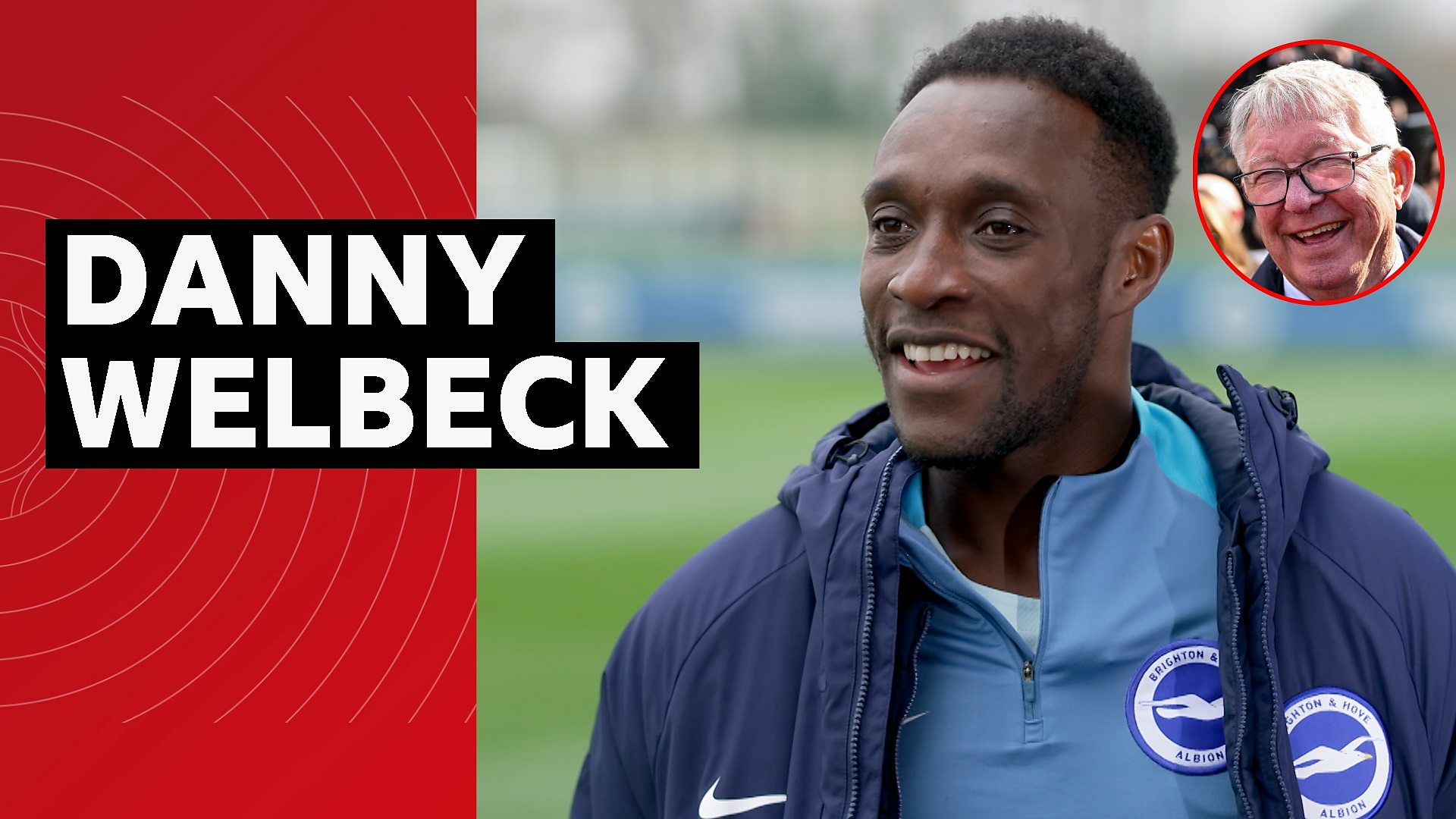 Danny Welbeck Hair