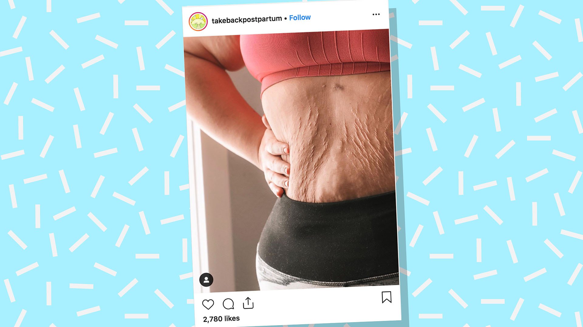 #bodyafterbaby: Why women are sharing pictures of their post-birth ...