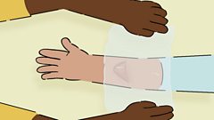 Bone fractures - BBC Teach