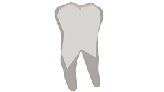 Teeth – KS2 Science curriculum - BBC Bitesize