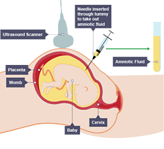 What are X and Y chromosomes and genetic screening in GCSE Biology ...