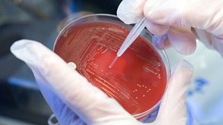 Culturing - Environmental control of metabolism - Higher Biology ...